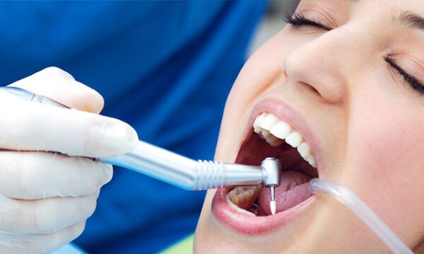 Subgingival Küretaj | Ankara İmplant Ortodonti Diş Kliniği